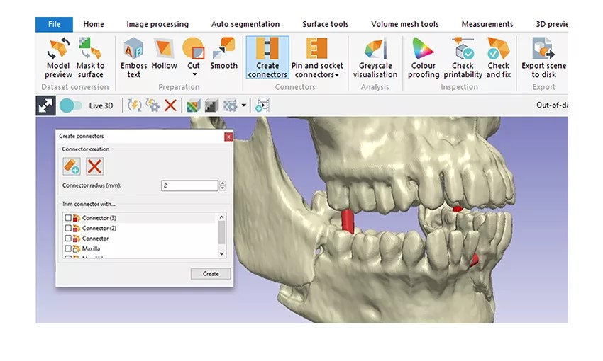 Simpleware 軟體於醫療 3D 列印的應用 - 艾索科技